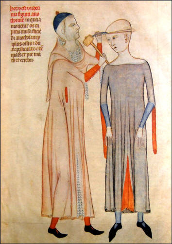 How Medieval Medicine is Helping us Today – Just History Posts